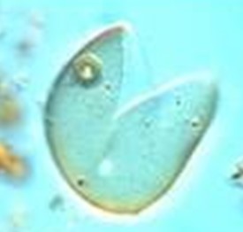 Wetlands of Lower New and Hondo Rivers, Belize, with Pulltrouser Swamp ...